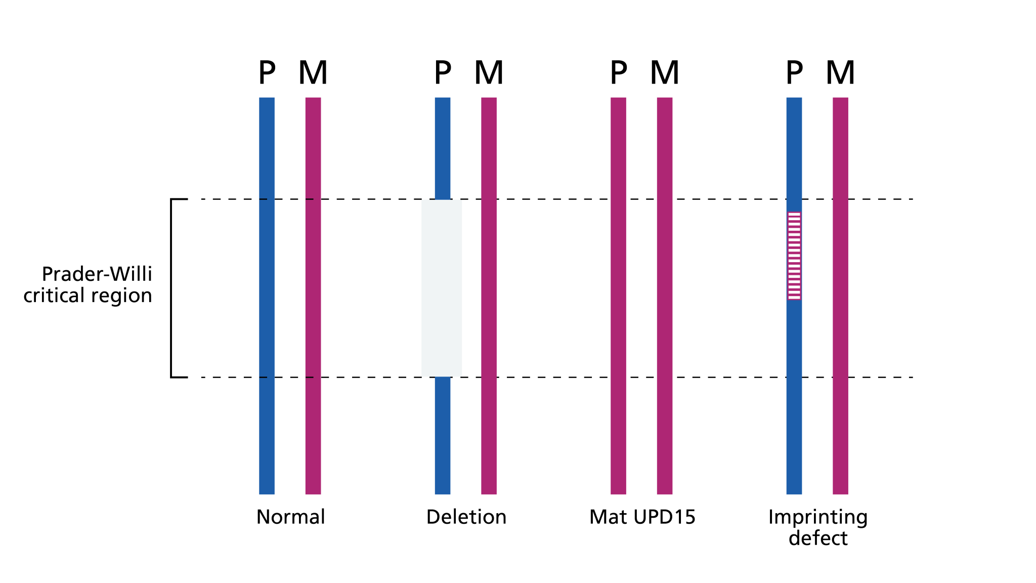 Prader-Willi syndrome — Knowledge Hub