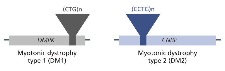 Myotonic dystrophy — Knowledge Hub