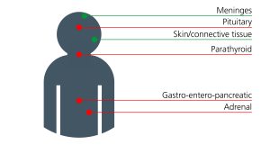 Multiple endocrine neoplasia type 1 — Knowledge Hub