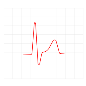 Short QT syndrome — Knowledge Hub