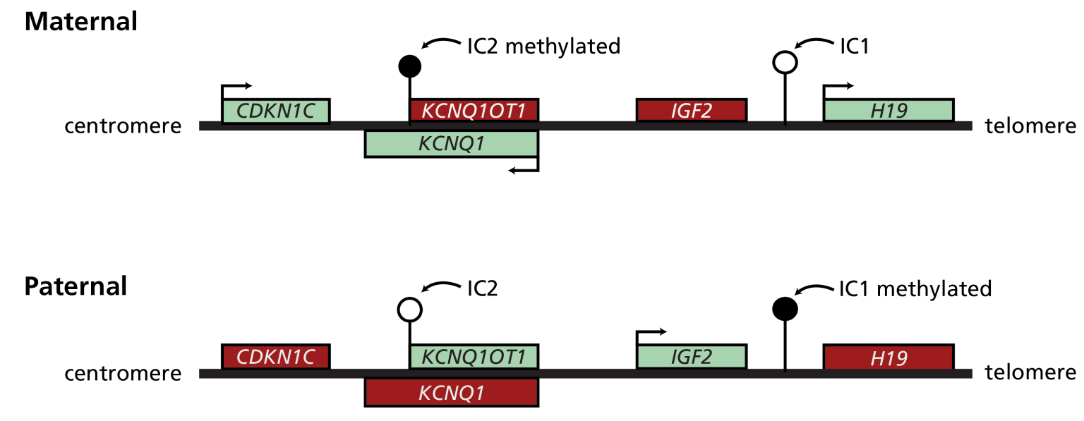 Beckwith-Wiedemann syndrome — Knowledge Hub