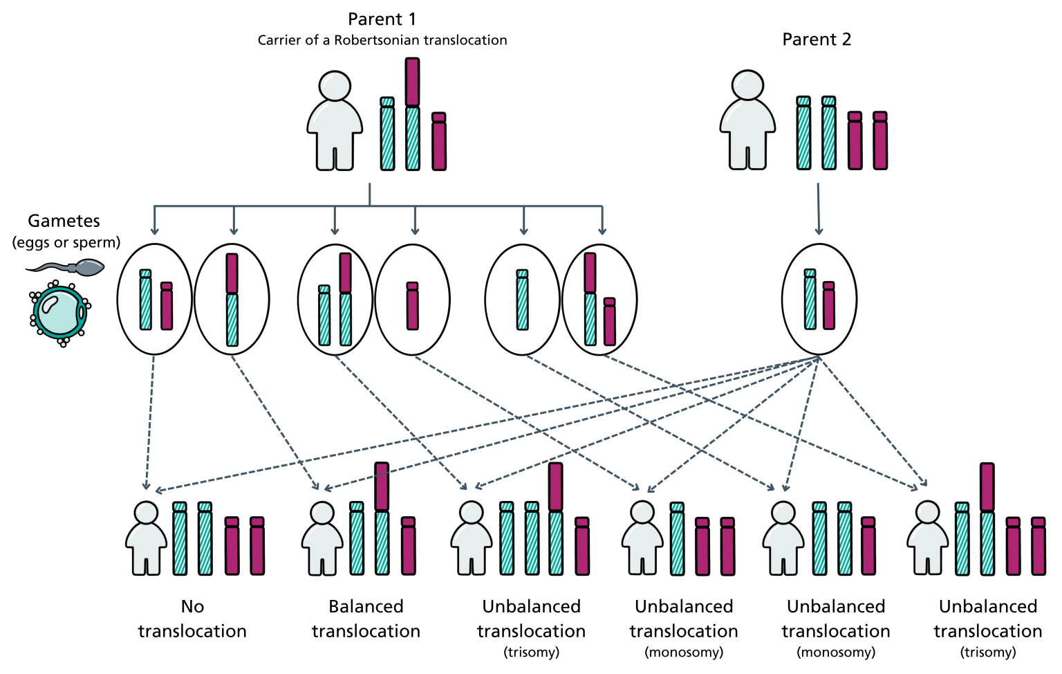 Visual communication aid: Robertsonian chromosome translocations ...