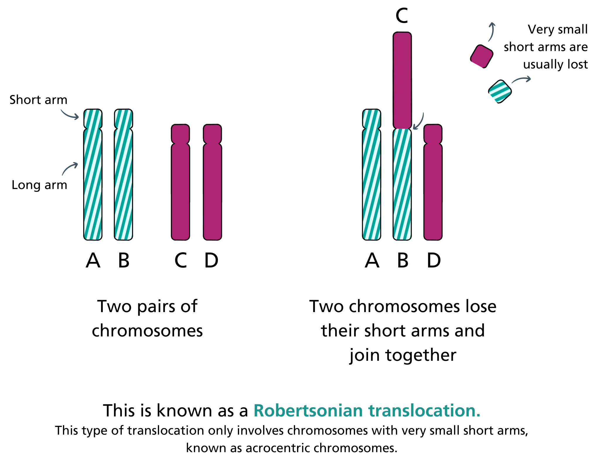 Visual communication aid: Robertsonian chromosome translocations ...