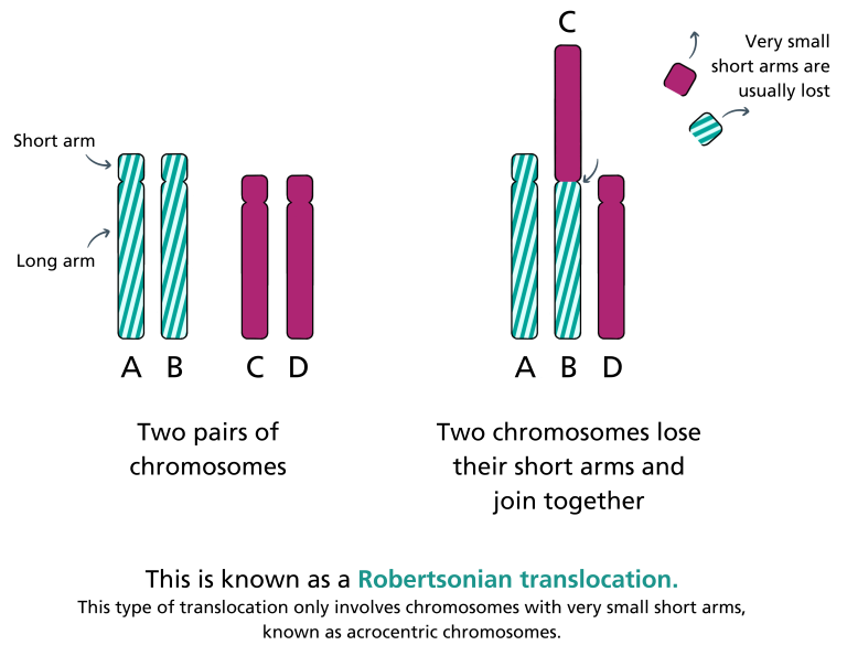 Visual communication aid: Robertsonian chromosome translocations ...